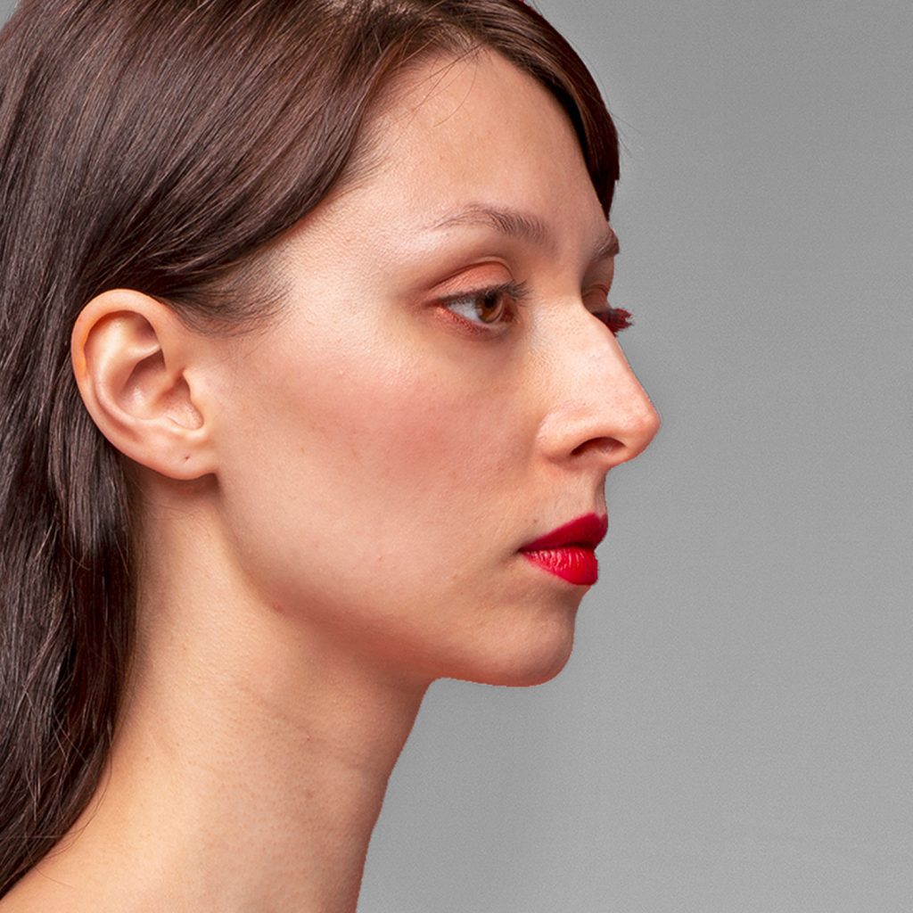 Rhinoplasty in Abu Dhabi - Nose Surgery, Plastic Surgery