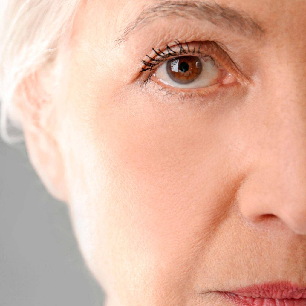Intralifting Abu Dhabi - Anti Aging Treatment- Face Sagging EWMC